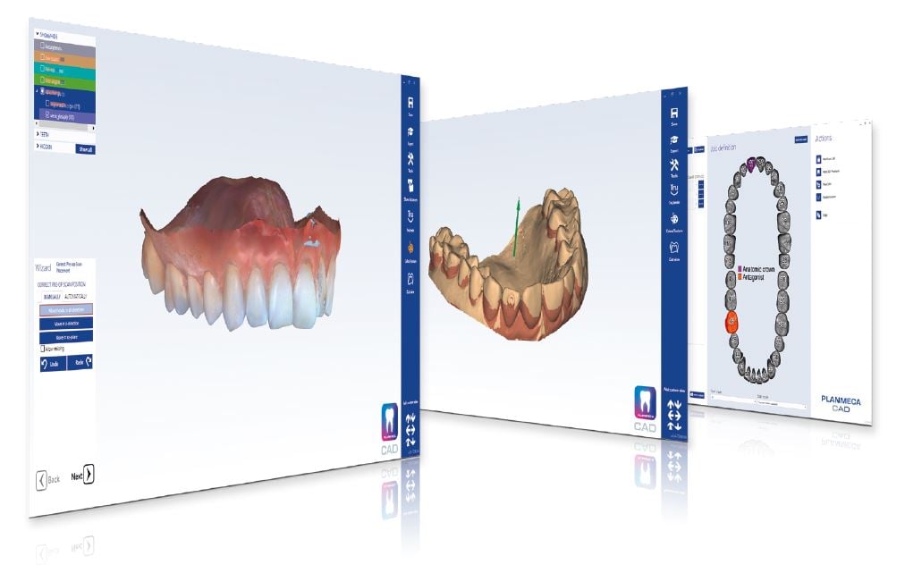 New software releases | Planmeca Romexis