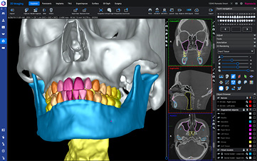 New software releases | Planmeca Romexis