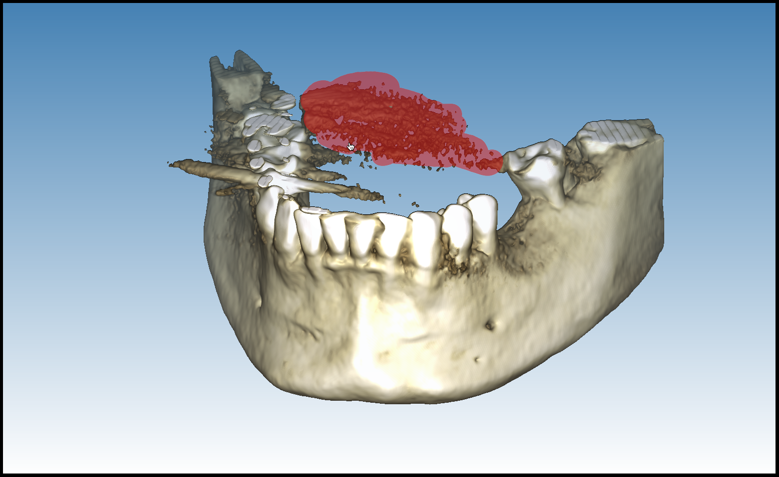 New software releases | Planmeca Romexis